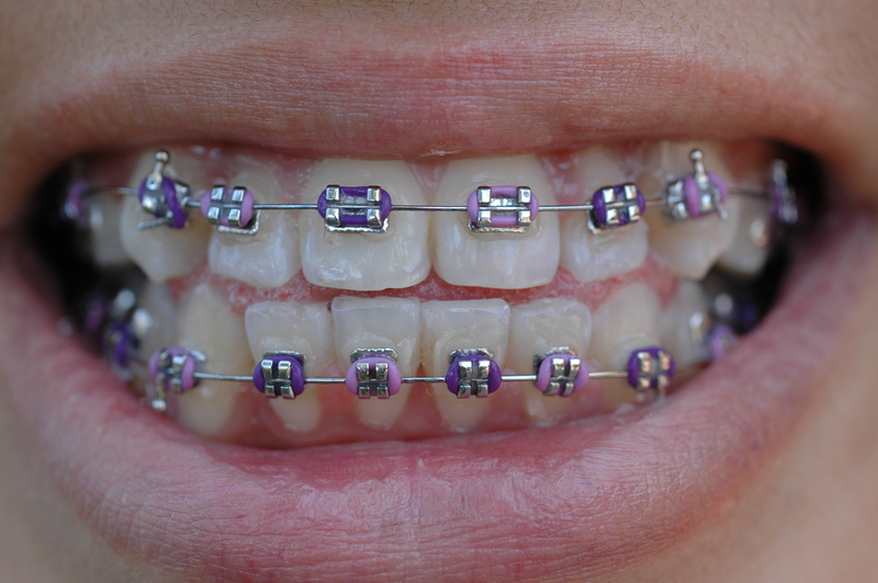 Setting Things Straight – Steve Hall